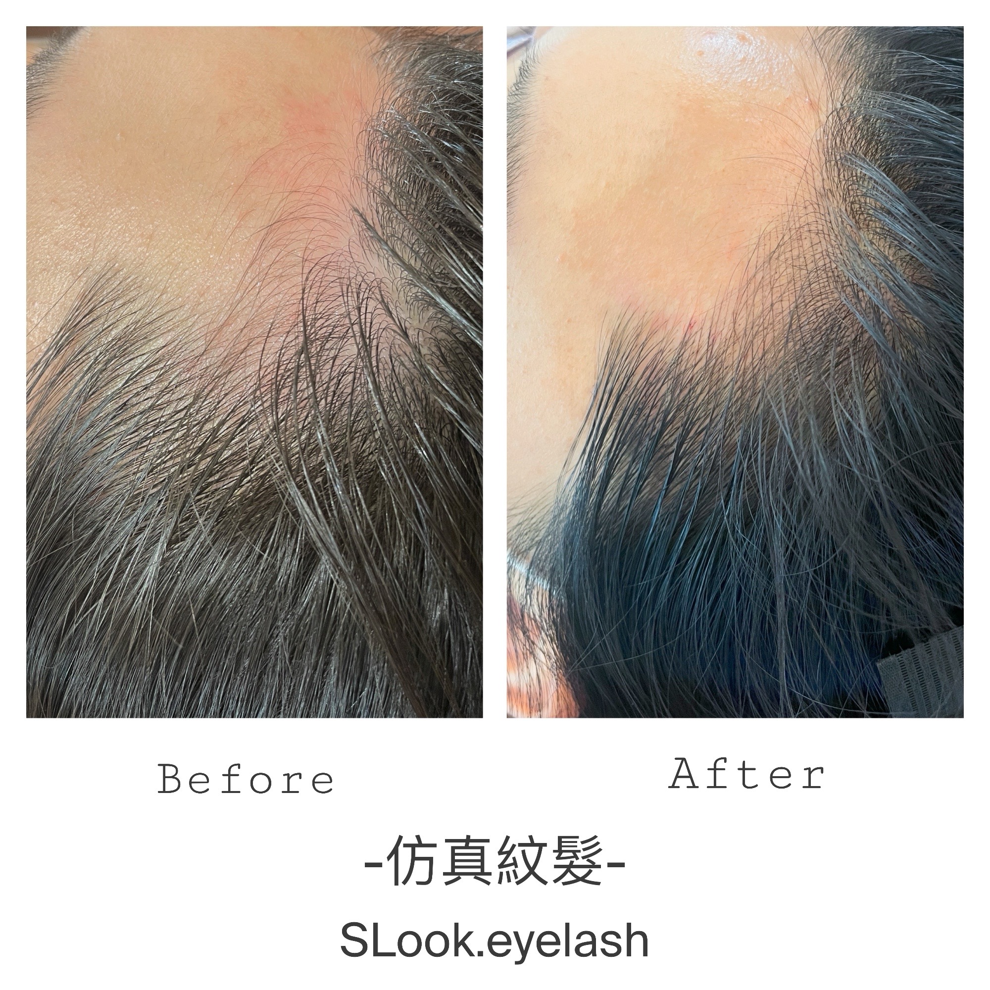 紋髮/髮際線 - SLook.eyelash半永久紋繡/紋髮際線/角蛋白美睫設計/皮膚管理
